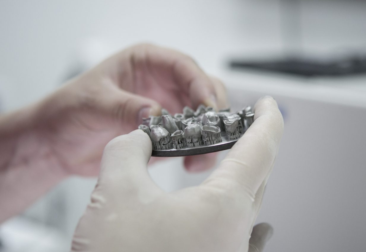 Revolutionizing Dental Labs with Metal 3D Printing | Nota3D Revolutionizing Dental Labs with Metal 3D Printing | Nota3D